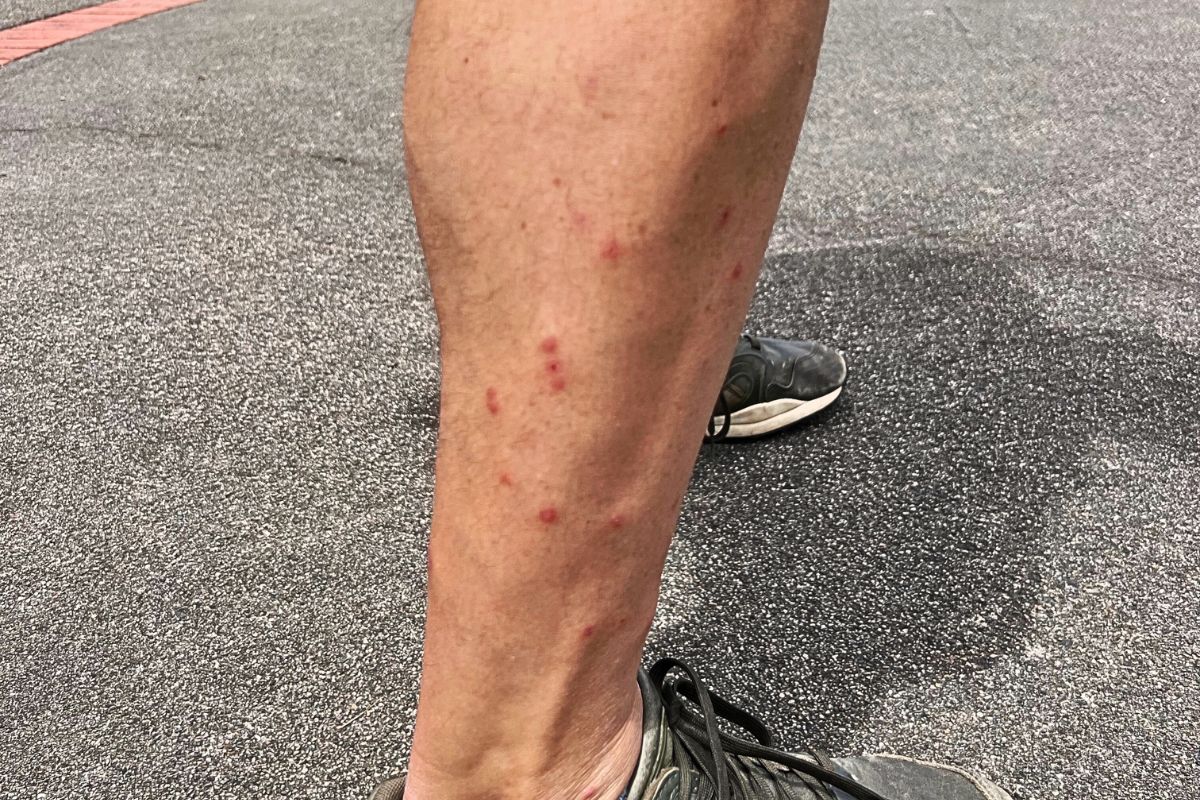 Sandflies in Neuseeland: 8 Tipps zur Abwehr & Behandlung!